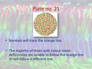 Color Vision Deficiency and Ishihara's Test | PPSX