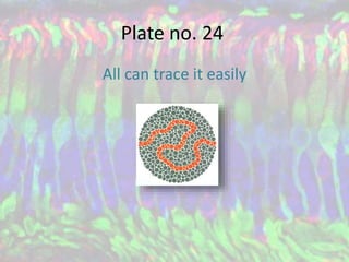 Color Vision Deficiency and Ishihara's Test | PPSX