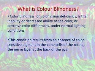 Color Vision Deficiency and Ishihara's Test | PPSX