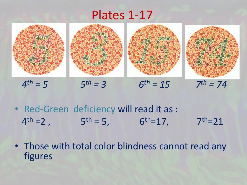Color Vision Deficiency And Ishihara s Test