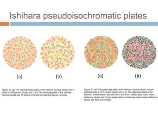 Color vision physiology, defects and different testing Procedures | PPT