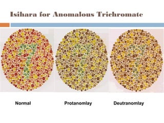 Color vision physiology, defects and different testing Procedures | PPT