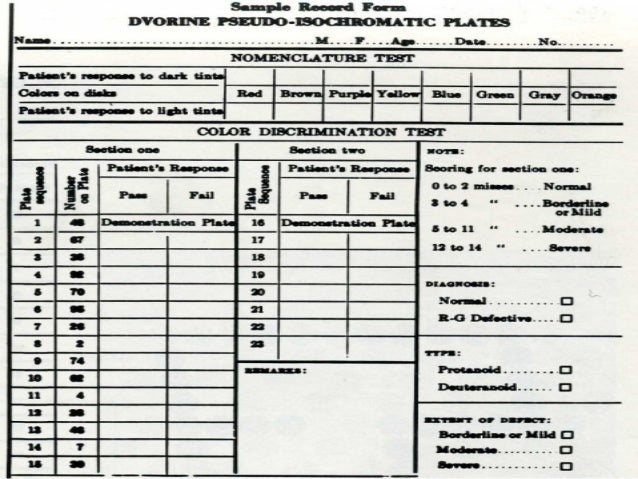 Color vision physiology, defects and different testing Procedures