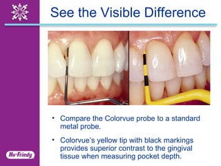 Colorvue Probes | PPT
