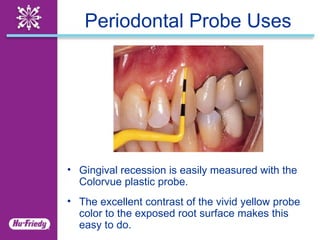 Colorvue Probes | PPT