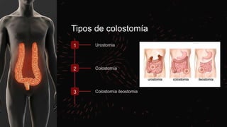 colostomía Lizbeth mamani diapositi.pptx