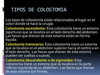 Colostomia | PPTX