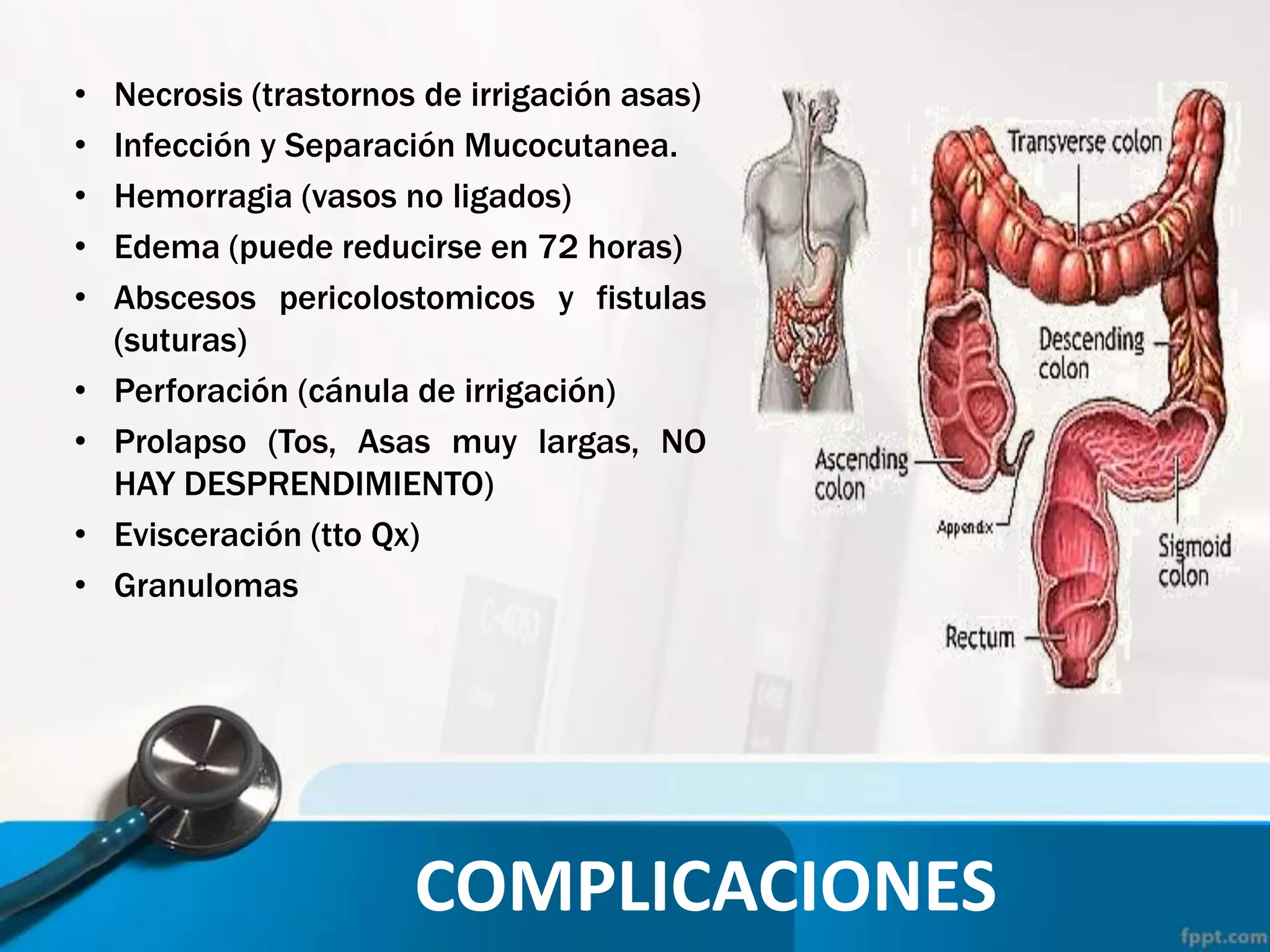 COLOSTOMIA - TECNICA QUIRURGICA E INSTRUMENTAL | PPTX