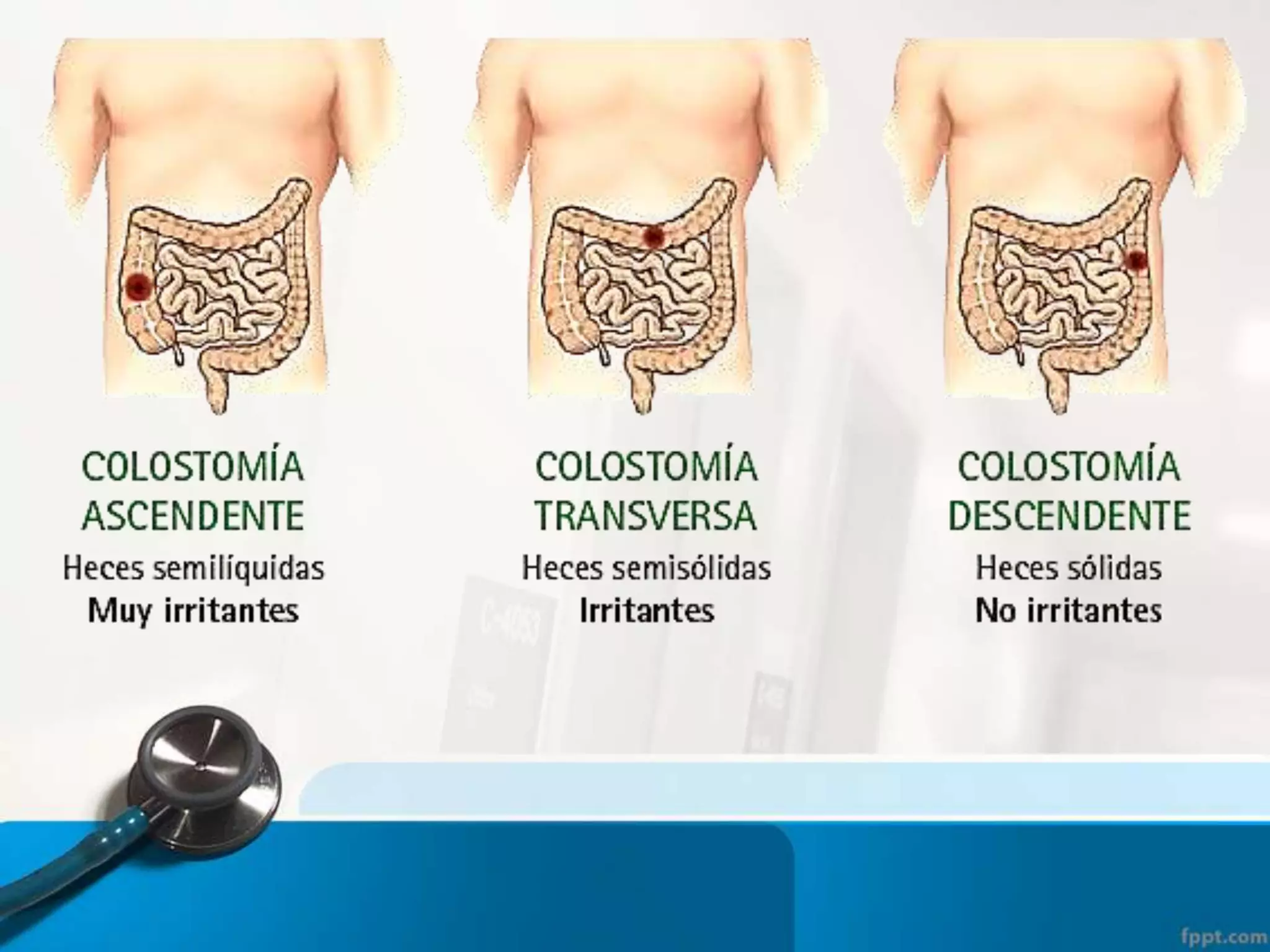 COLOSTOMIA - TECNICA QUIRURGICA E INSTRUMENTAL | PPTX