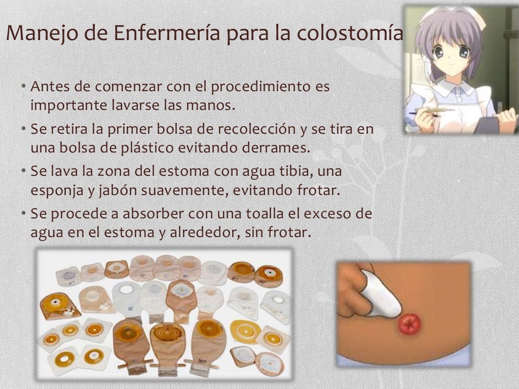 Colostomia