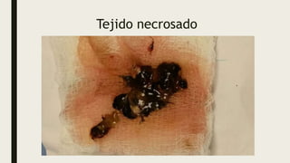 COLOSTOMIA.pptx