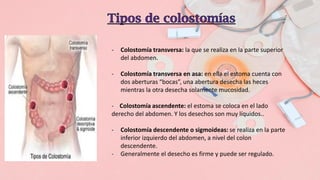 COLOSTOMIA.pdf