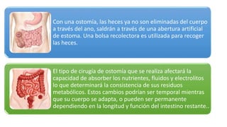 colostomia2.0.pptx