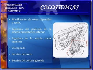 COLOSTOMIA , tipos y descripcionesJOHANNA.pptx