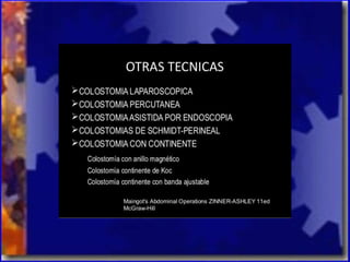 COLOSTOMIA , tipos y descripcionesJOHANNA.pptx