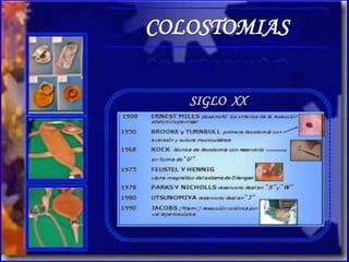 COLOSTOMIA , tipos y descripcionesJOHANNA.pptx
