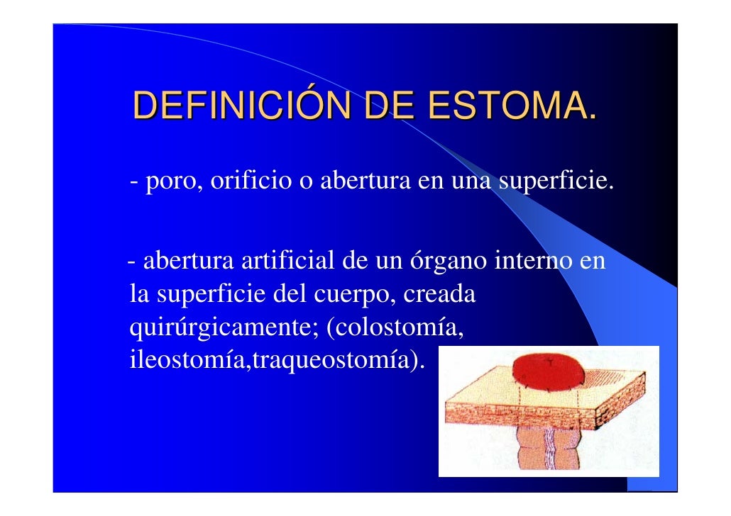 Colostomias ileostomias