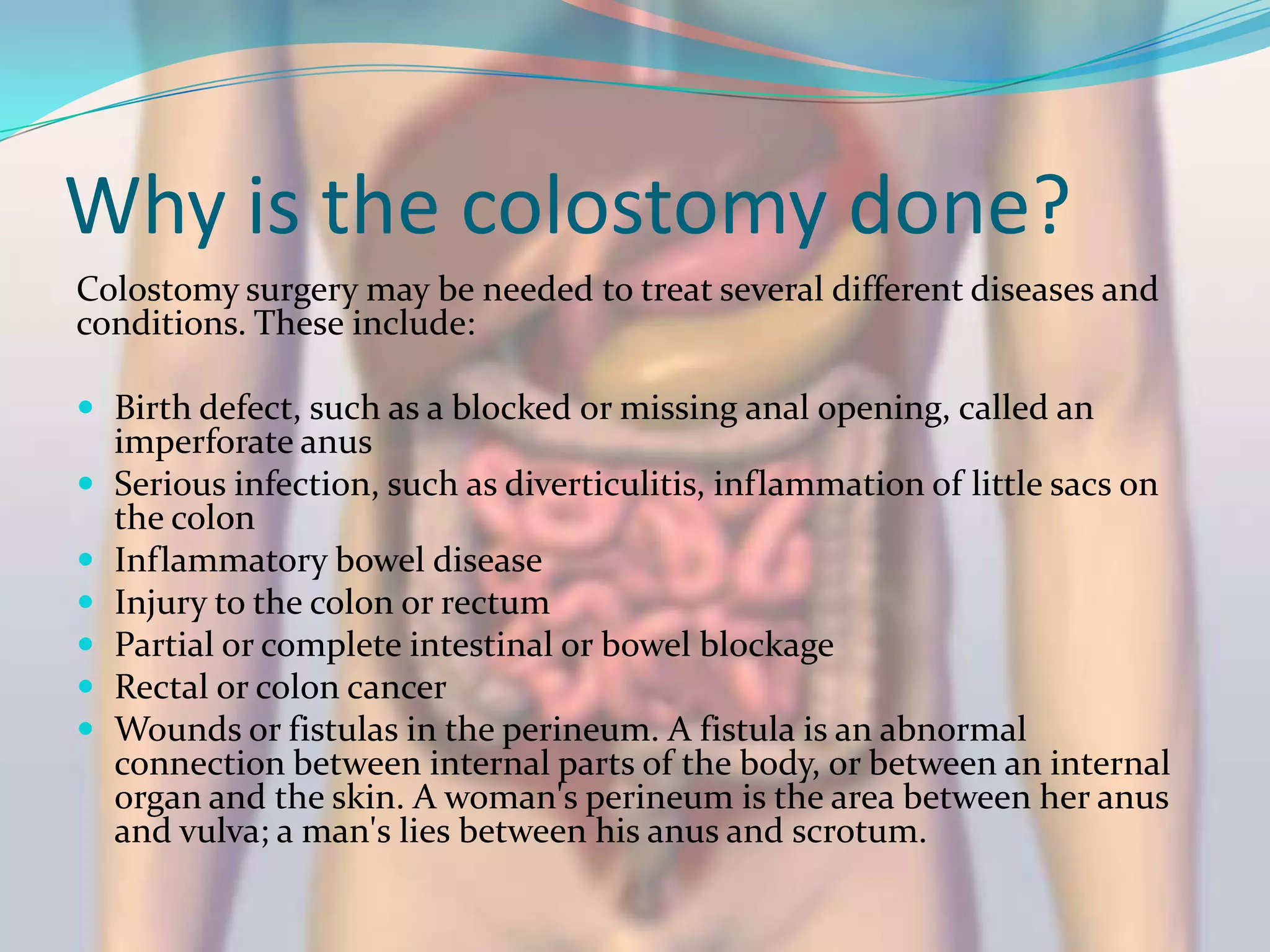 Colostomies project | PPTX