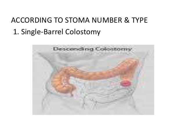 Colostomy