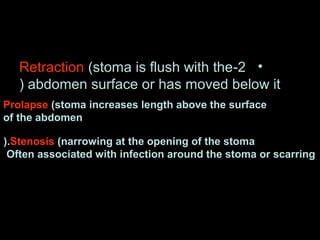 Colostomy | PPT | Digestive Disorders | Diseases and Conditions