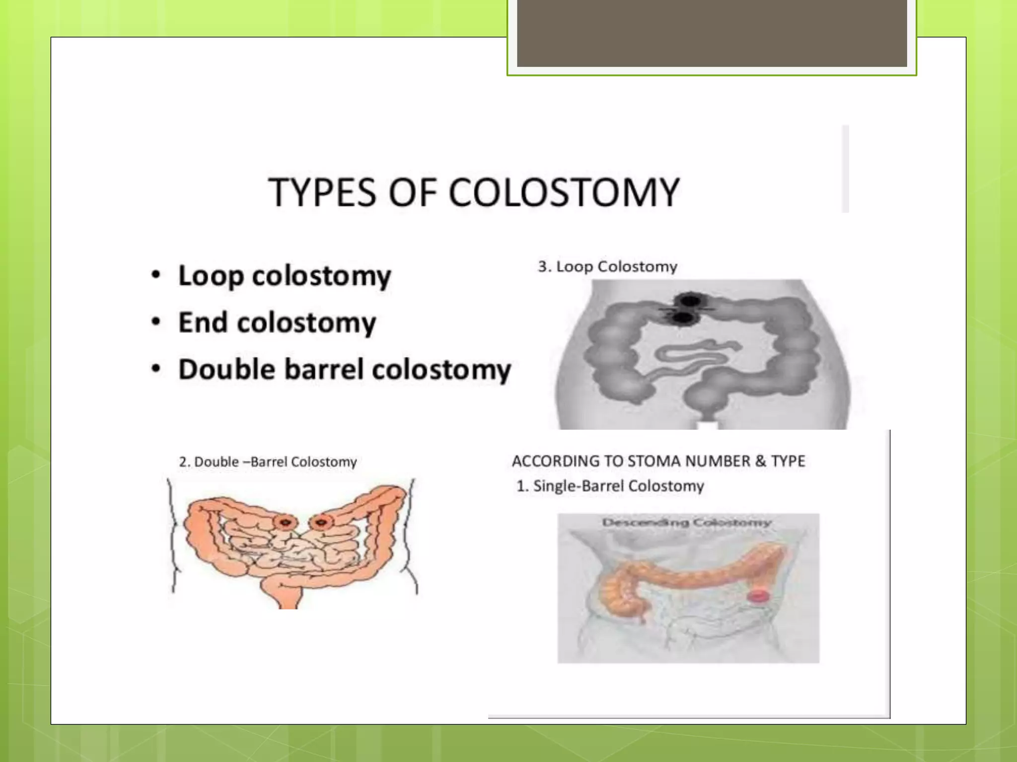 Colostomy | PPTX
