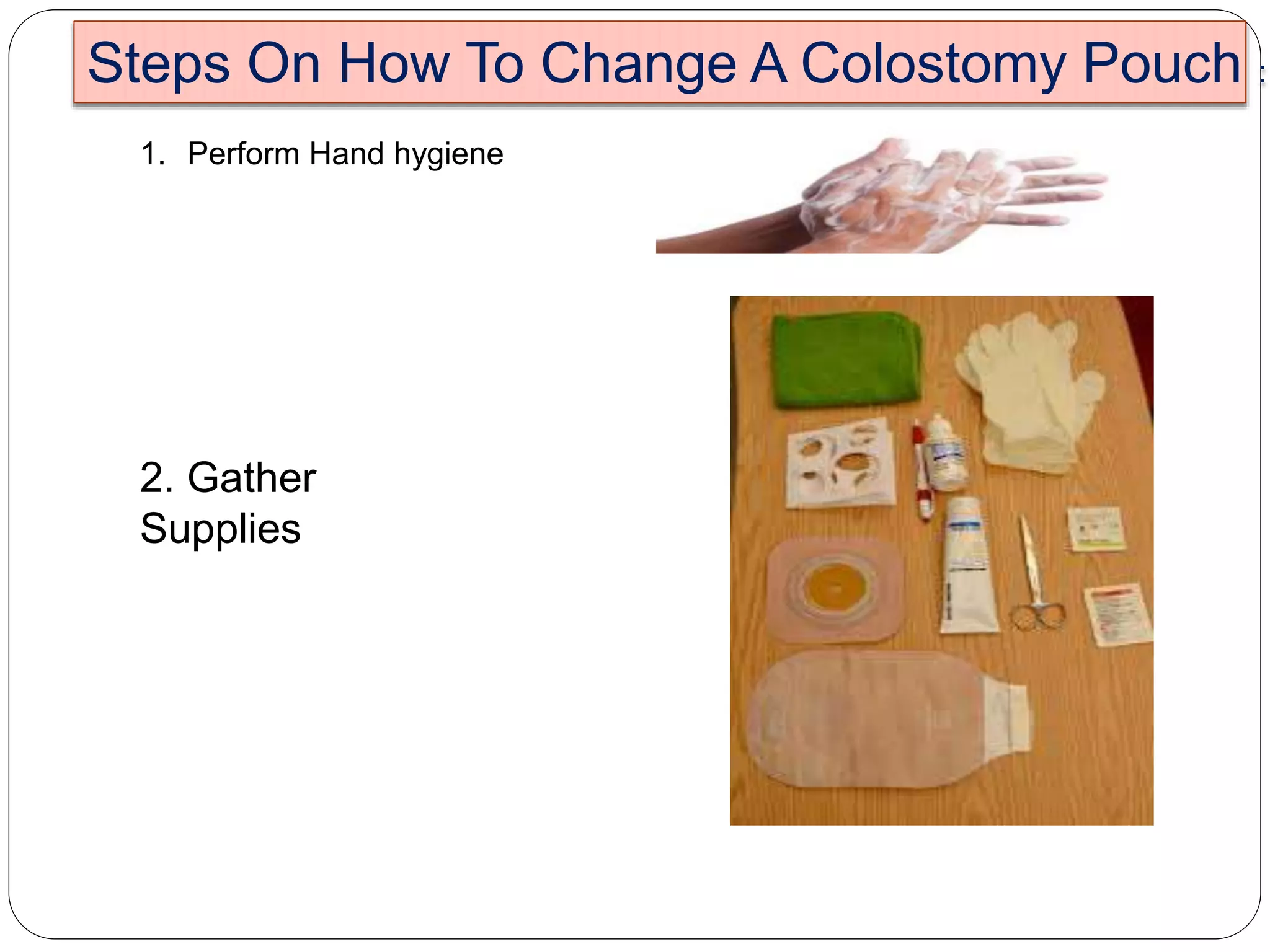 Colostomy care | PPTX