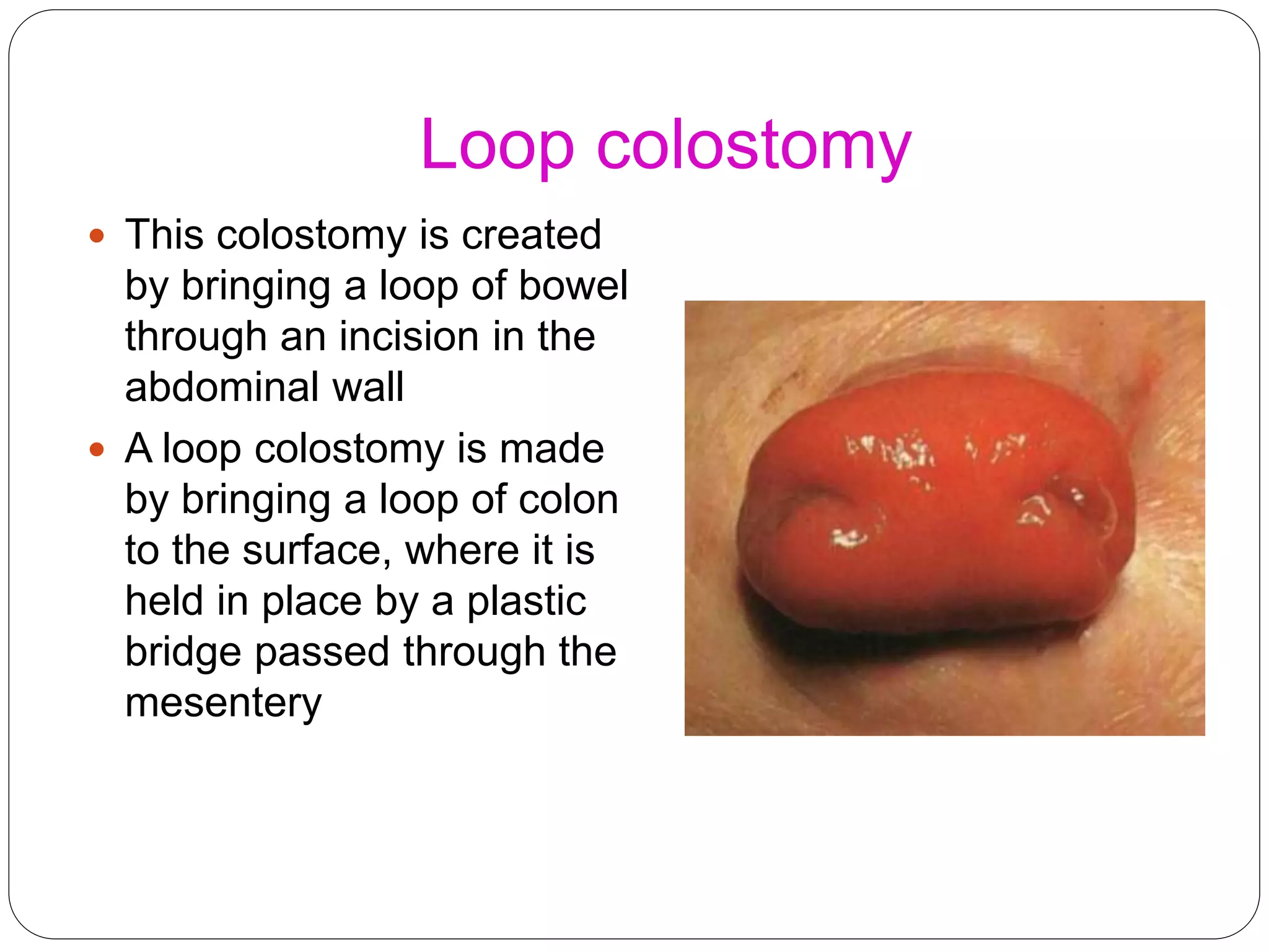 COLOSTOMY.ppt