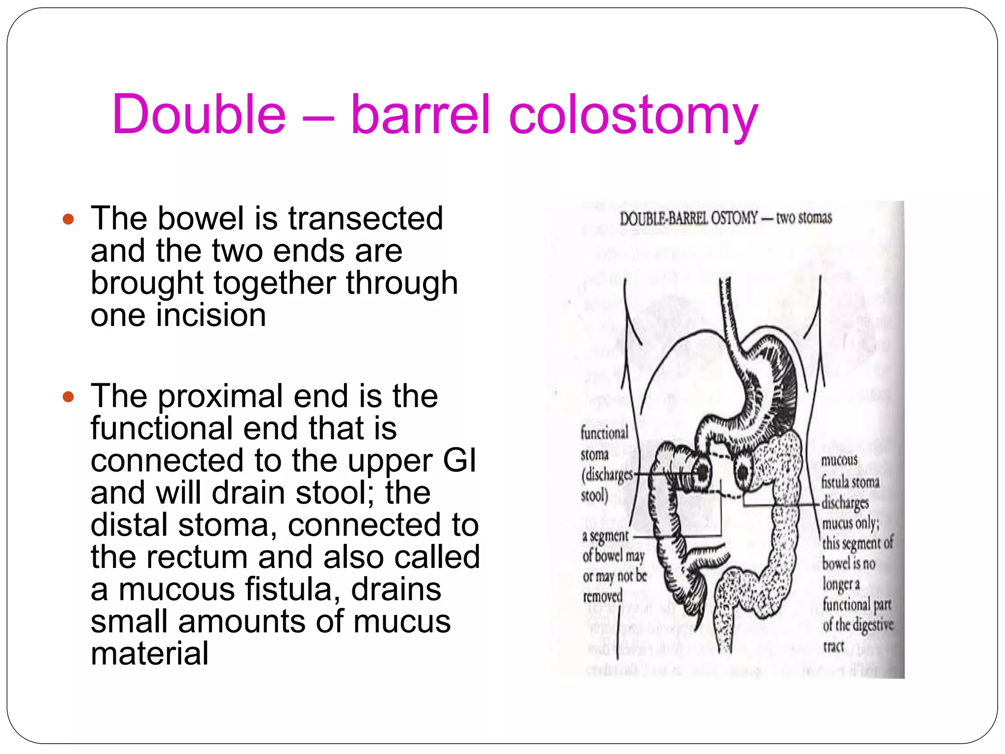 COLOSTOMY.ppt | Digestive Disorders | Diseases and Conditions