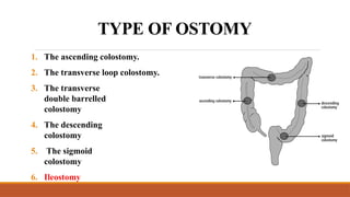 colostomy.pptx management anf care of patient | PPT