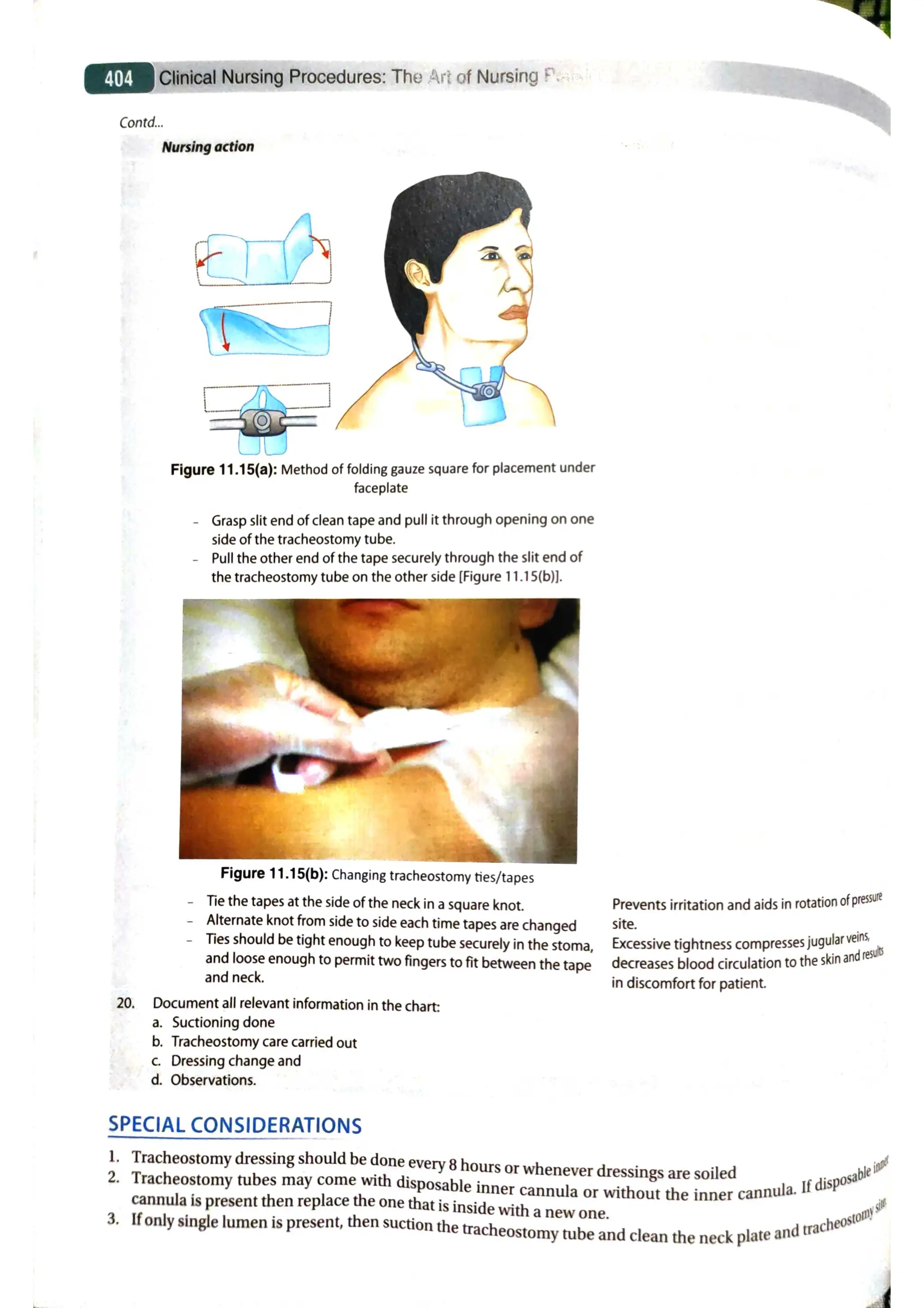 colostomy and tracheostomy care.pdf