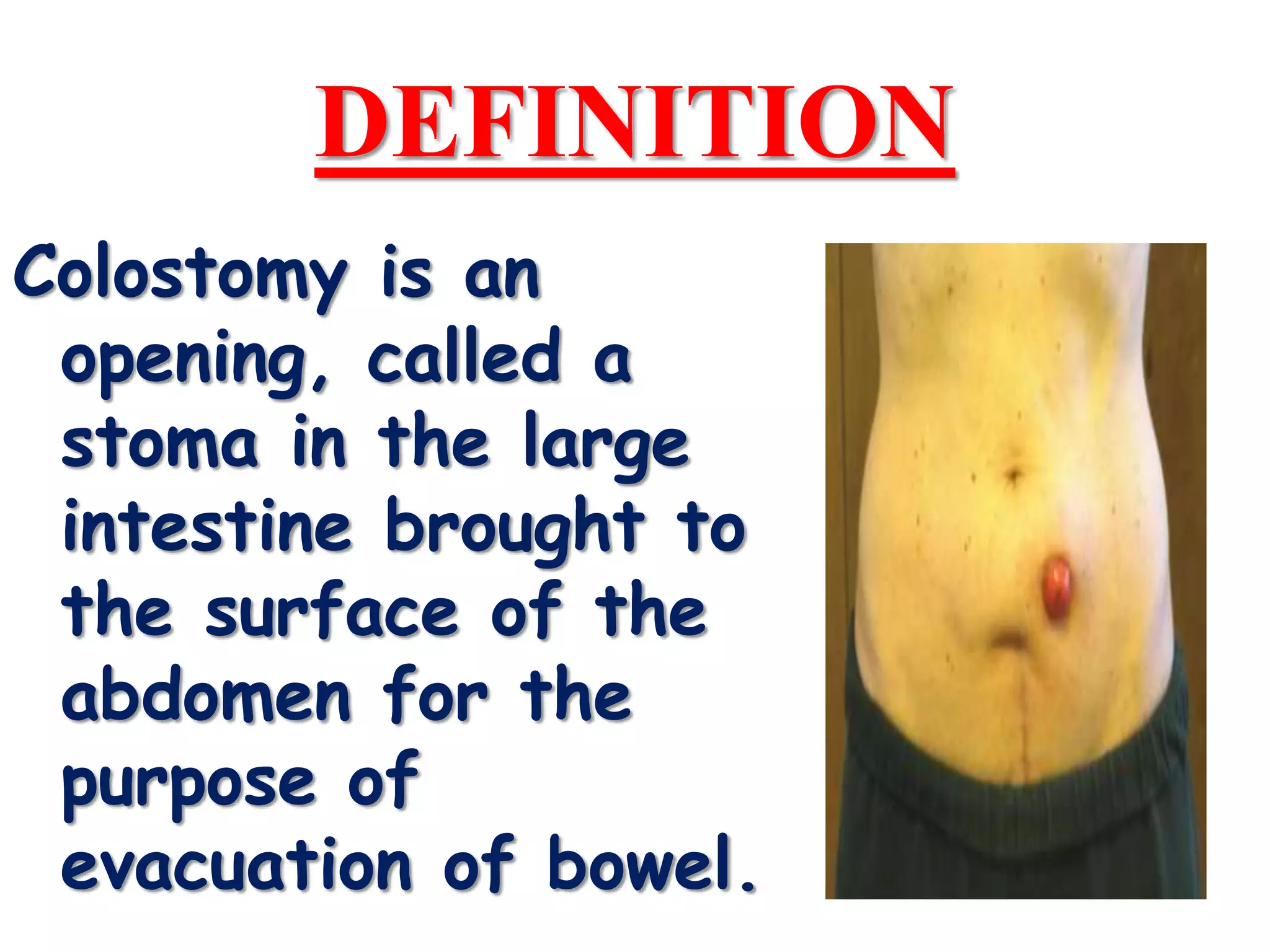 Colostomy care