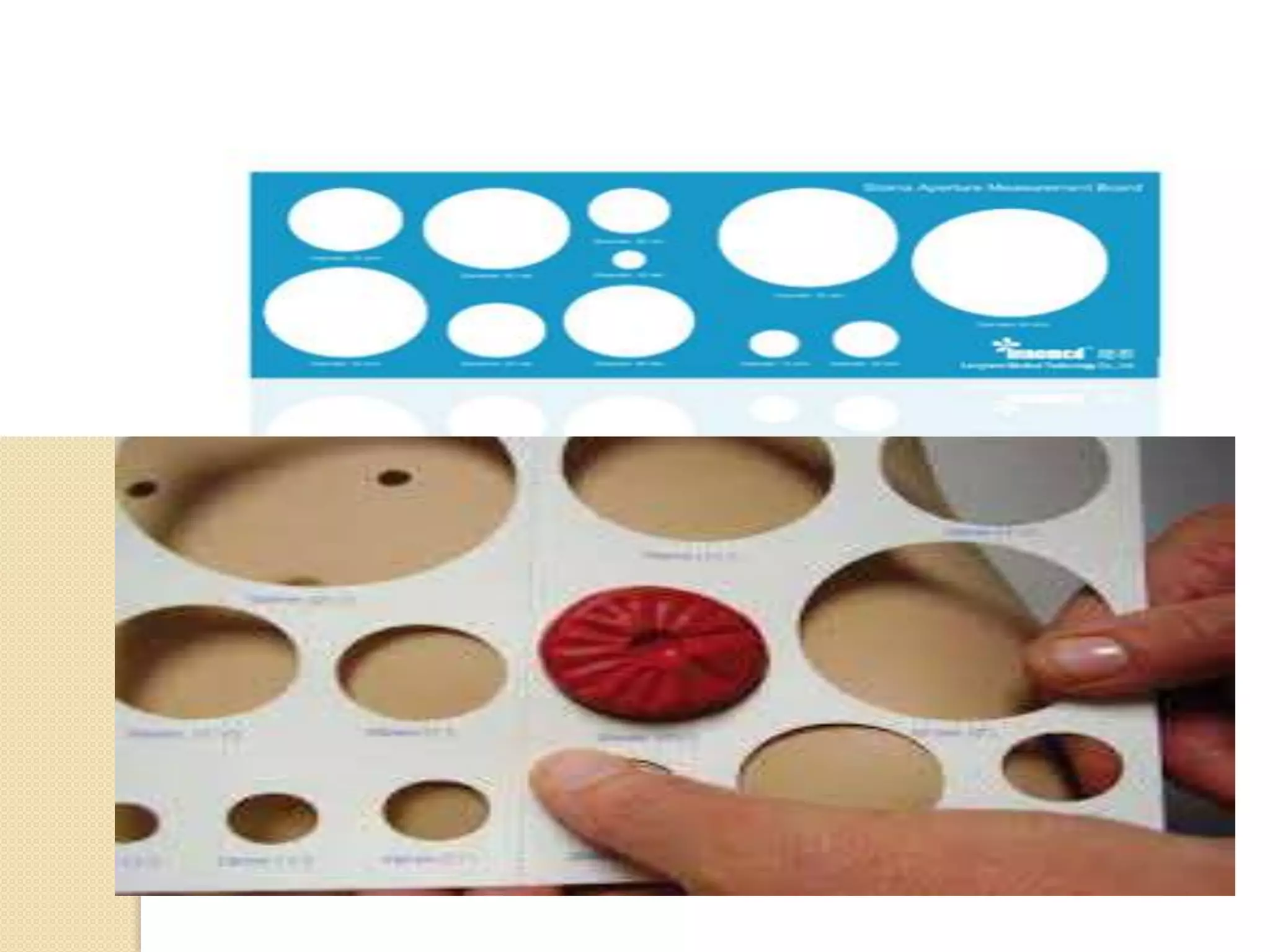 Colostomy care | PPTX