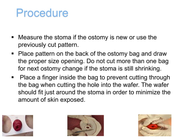 Colostomy care | PPTX | Digestive Disorders | Diseases and Conditions