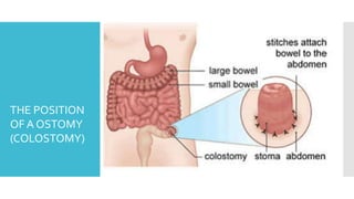 Colostomy Care.pptx