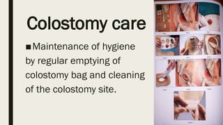 colostomy care presentation in nursing foundation | PPTX