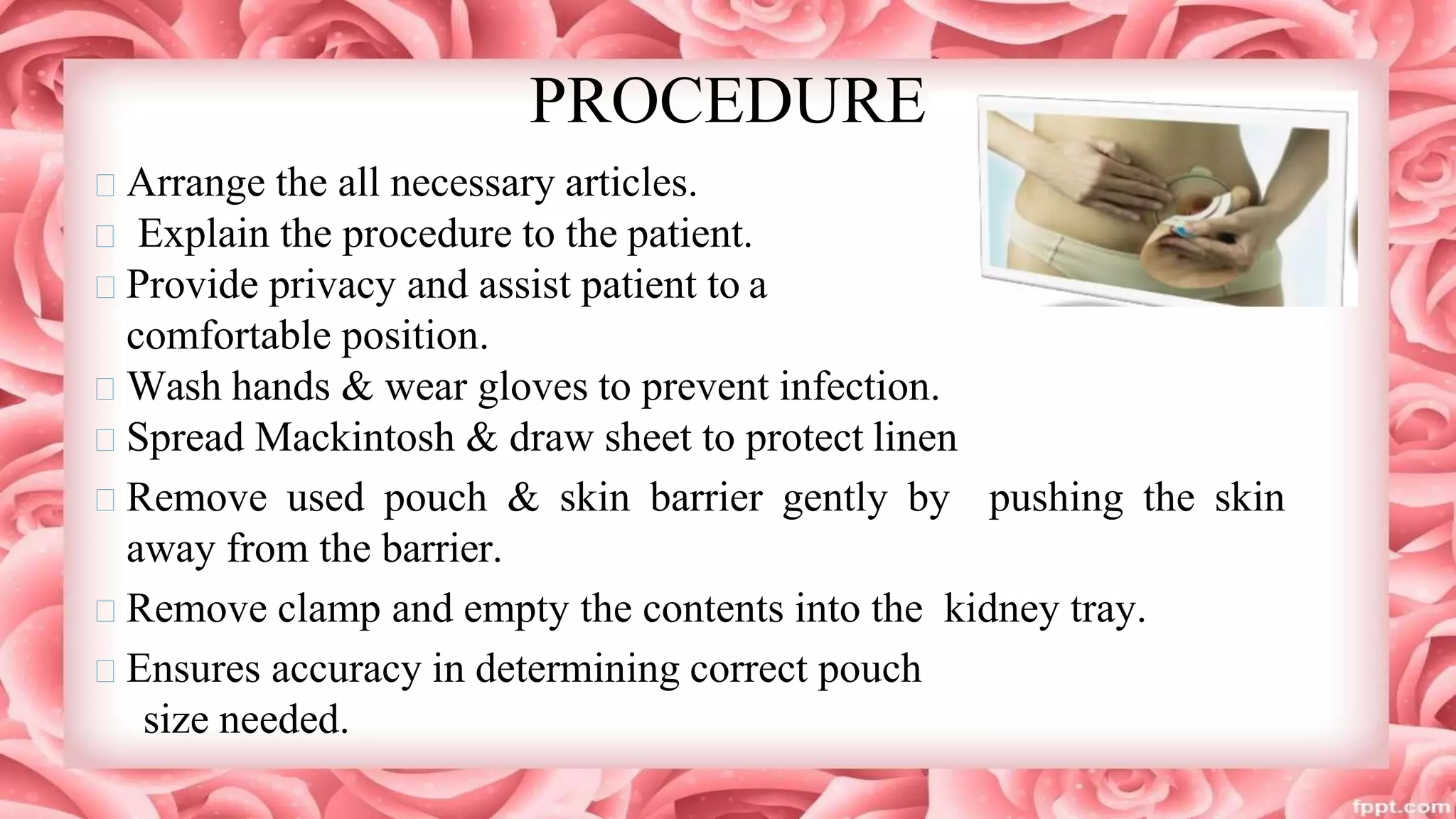 Colostomy care : Nursing management | PDF