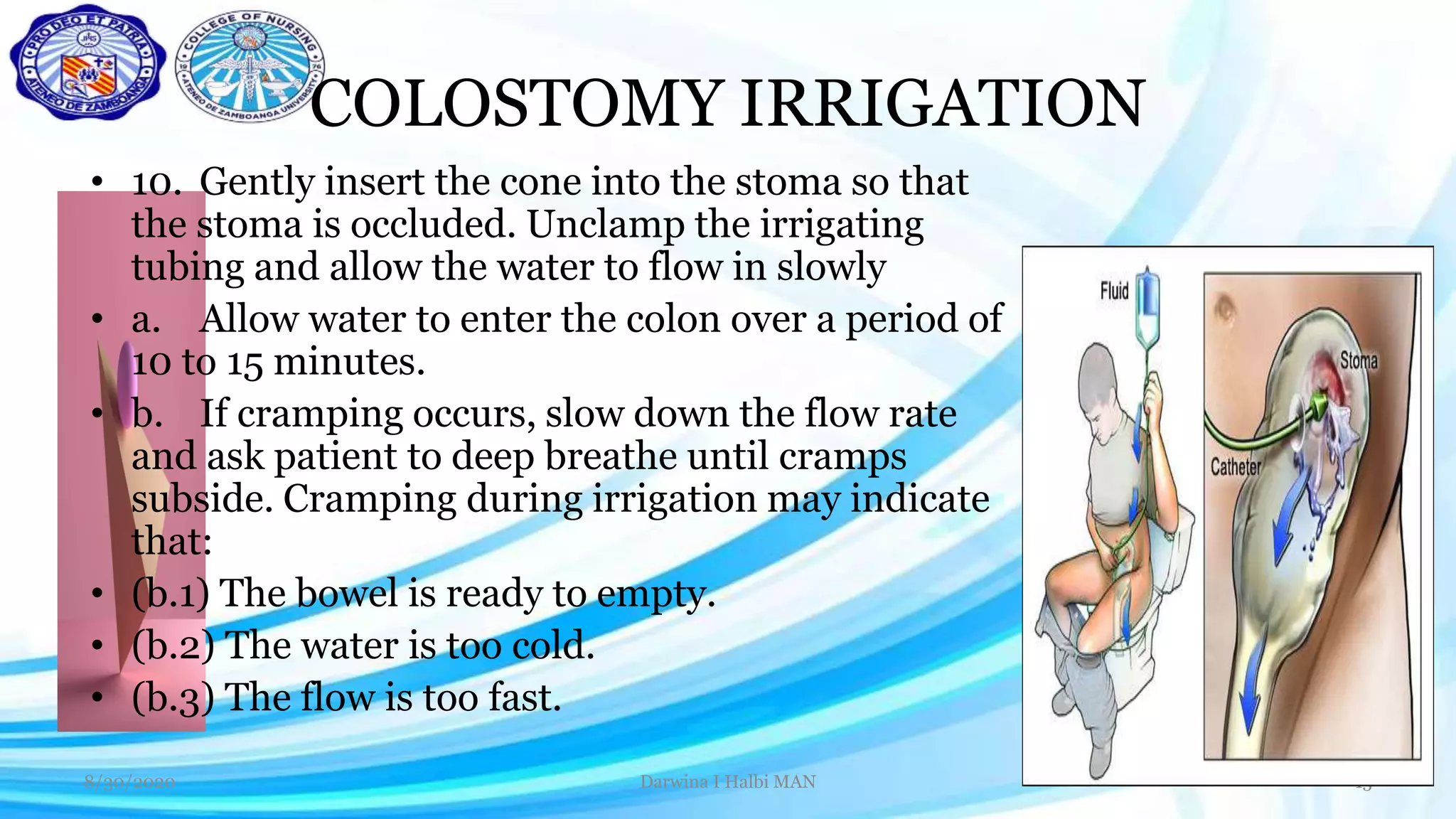 Colostomy irrigation | PPTX