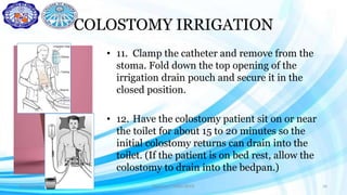 Colostomy irrigation | PPTX