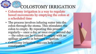 Sigmoid Colostomy Irrigation