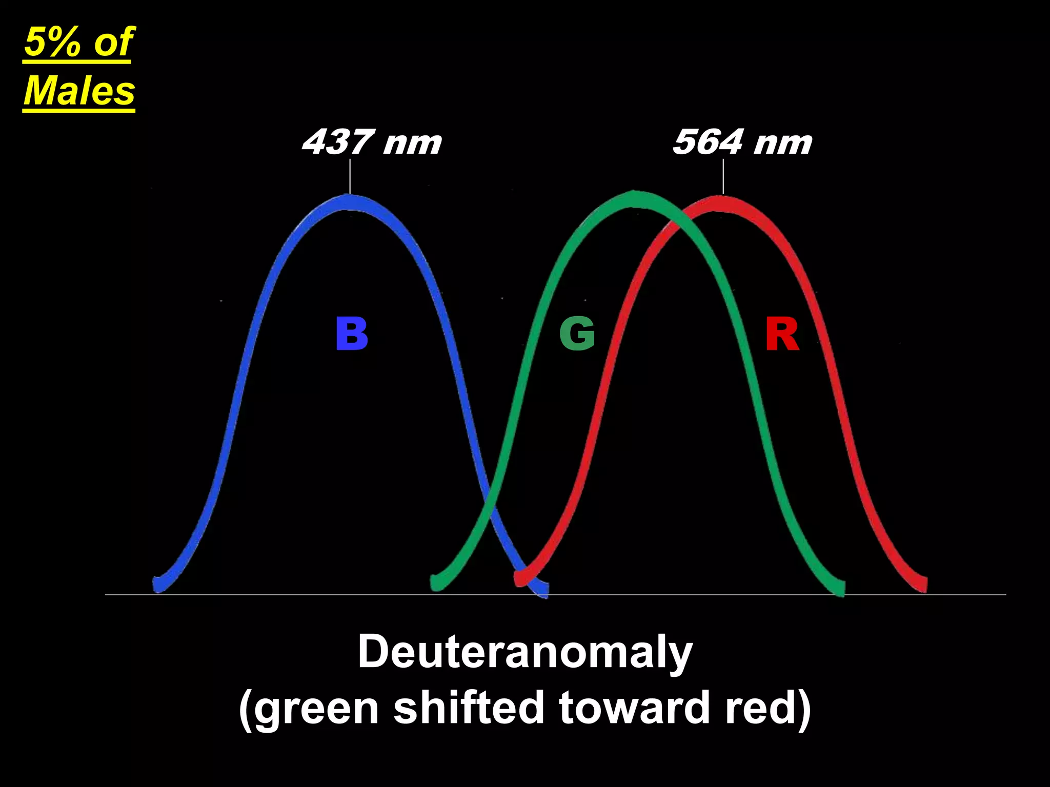 Colour blindness | PPTX