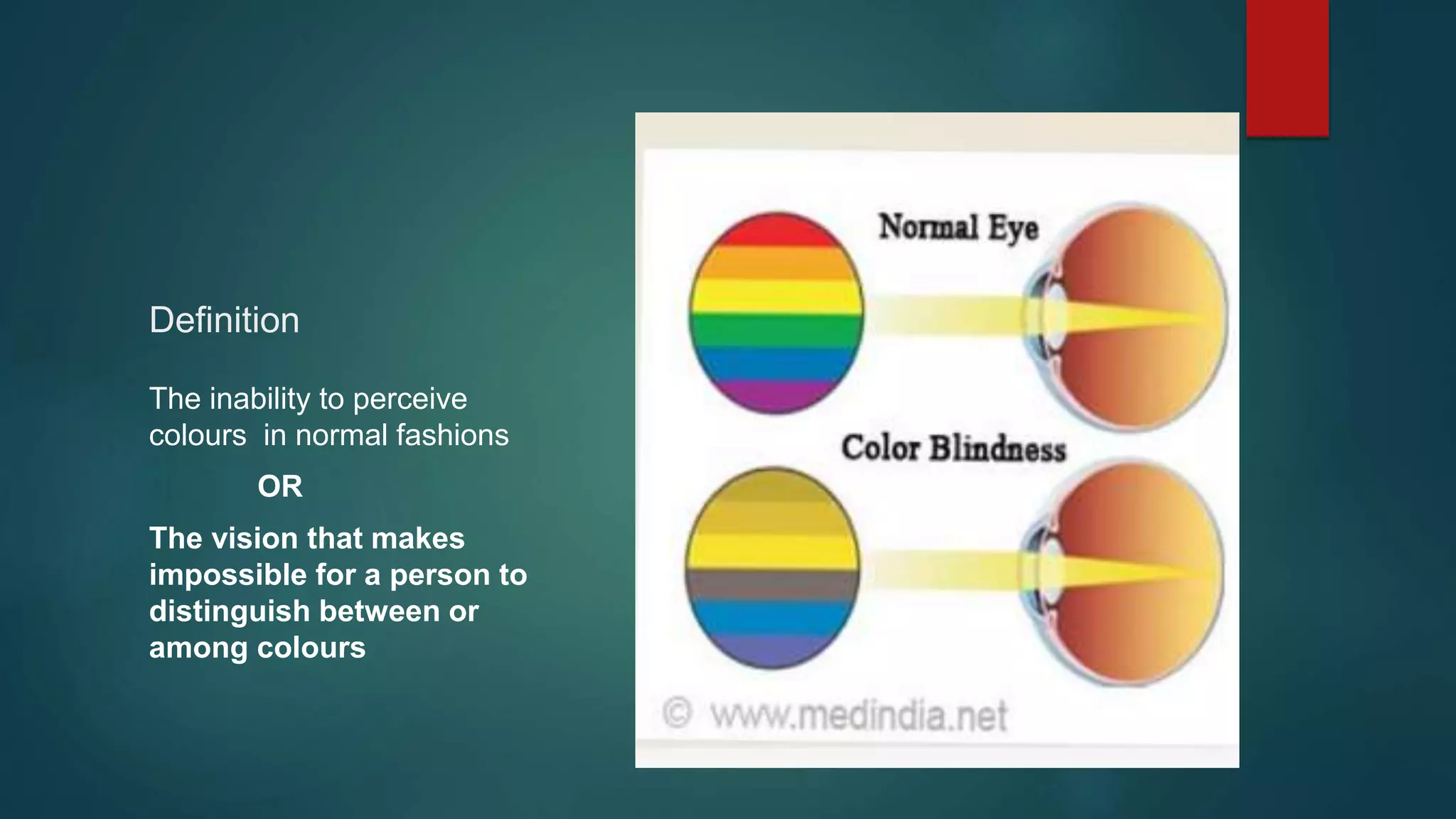 Colour blindness | PPTX