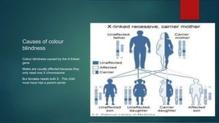 Colour blindness | PPTX