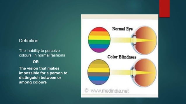 Colour blindness | PPT