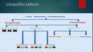 Colour blindness | PPTX