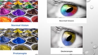 colour blindness practical in genetics ppt.pptx