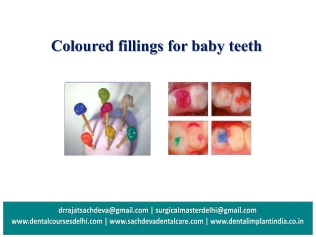 Coloured fillings for baby teeth | PPT