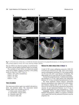 Colour Doppler ultrasound in controlled ovarian stimulation with ...