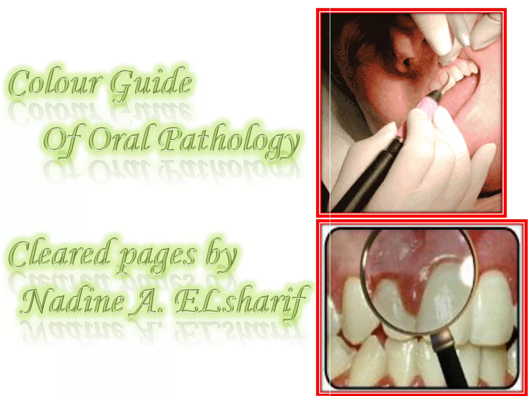 Colour guide of oral pathology | PPT