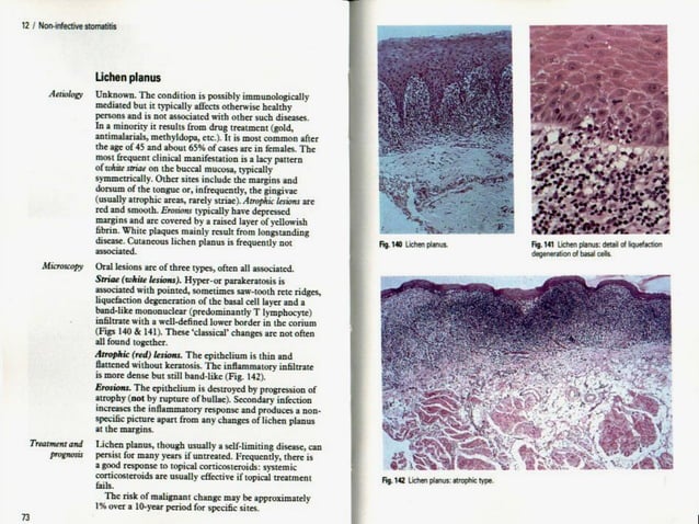 Colour guide of oral pathology | PPT