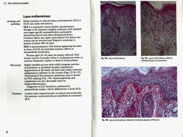 Colour guide of oral pathology | PPT